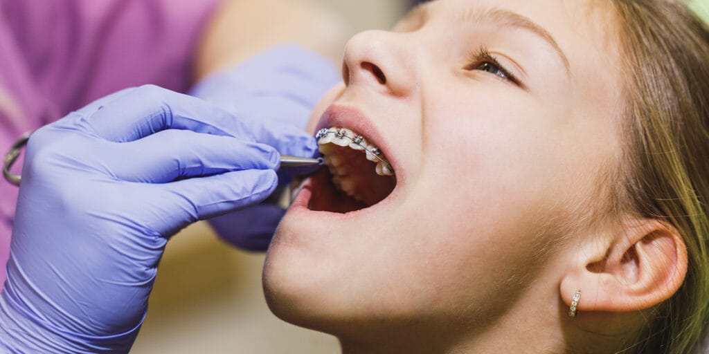 Common Orthodontic Issues | Families First Pediatrics | Orthodontics